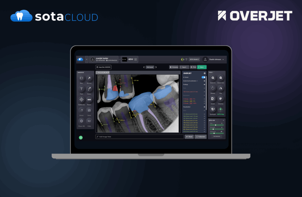 Cloud Imaging Meets Clinical AI: The SOTA Cloud × Overjet Integration Is Now Live
